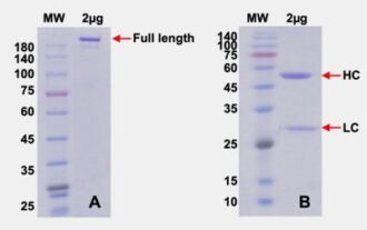 Custom protein expression services - 5 expression systems - ProteoGenix