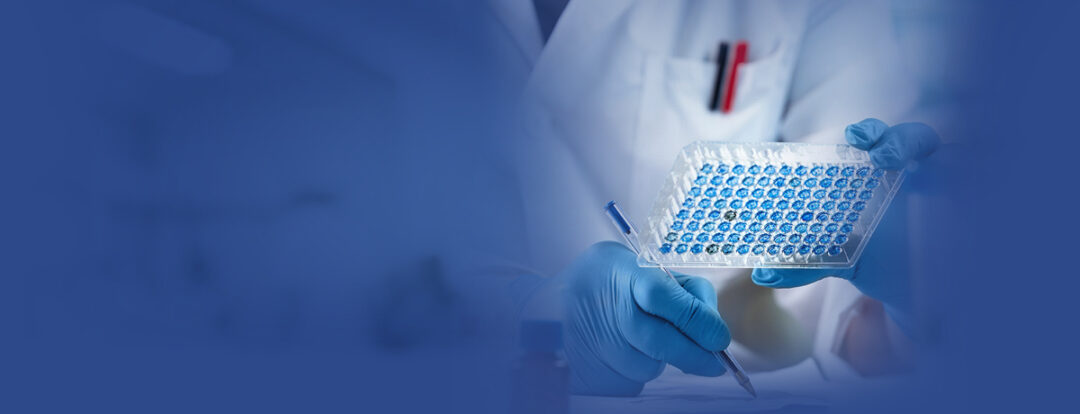 Custom Antibody Development & Production Service | ProteoGenix